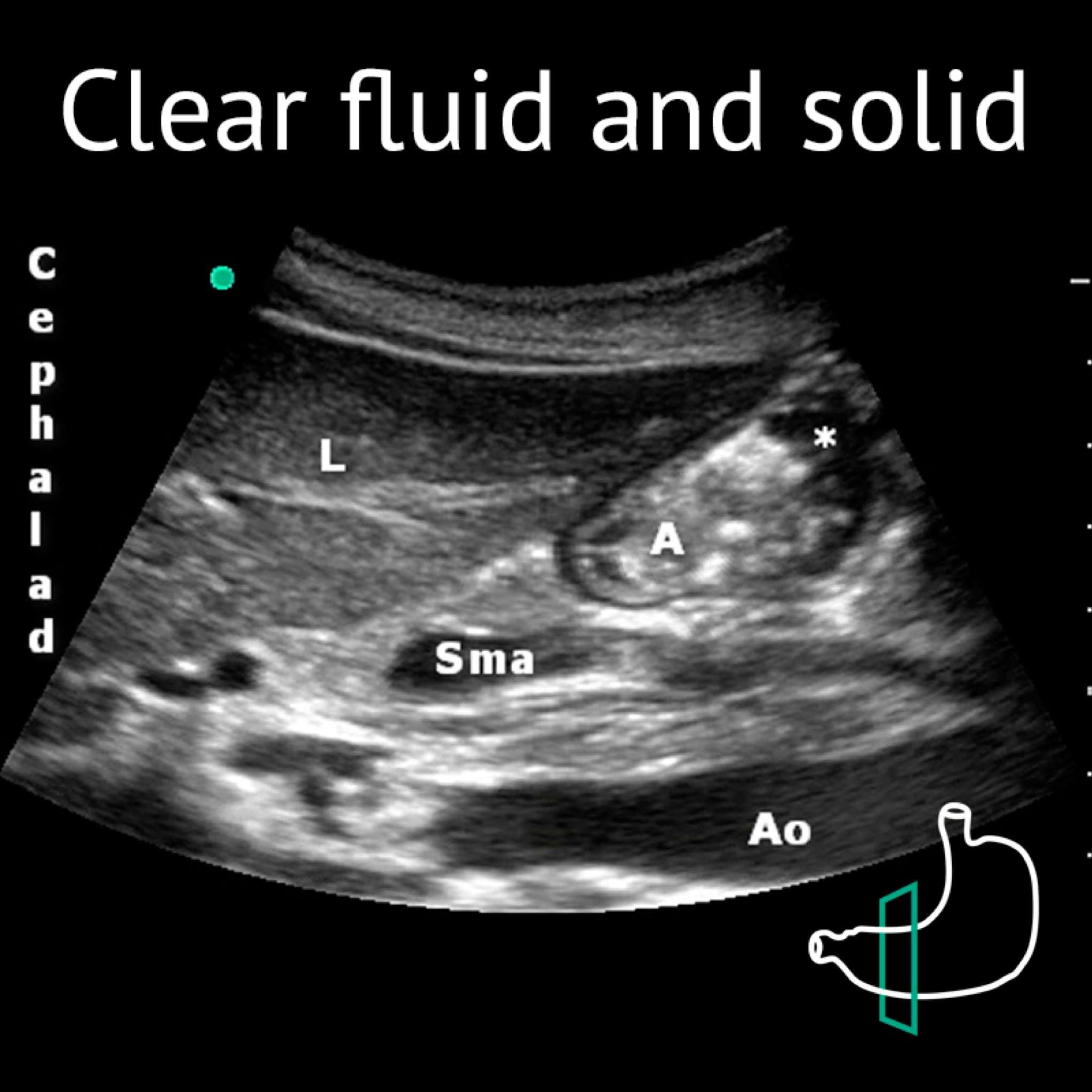Gastric UltraSound • Image Gallery