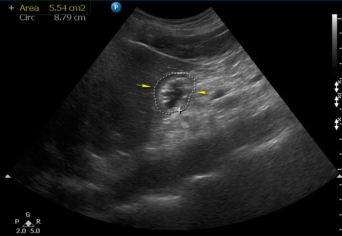 Gastric UltraSound • Image Acquisition